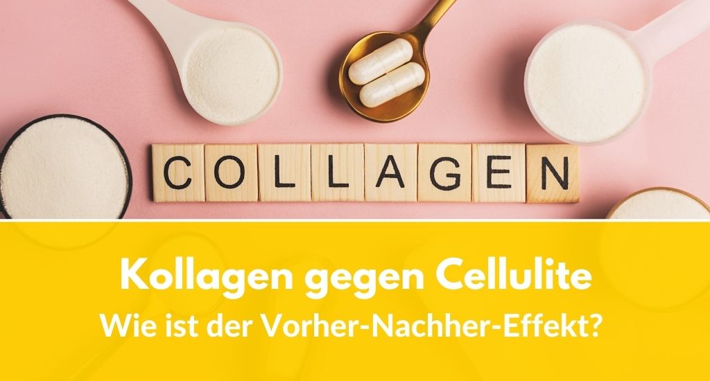 Kollagen gegen Cellulite: Wie ist der Vorher-Nachher-Effekt? – Senfsalbe